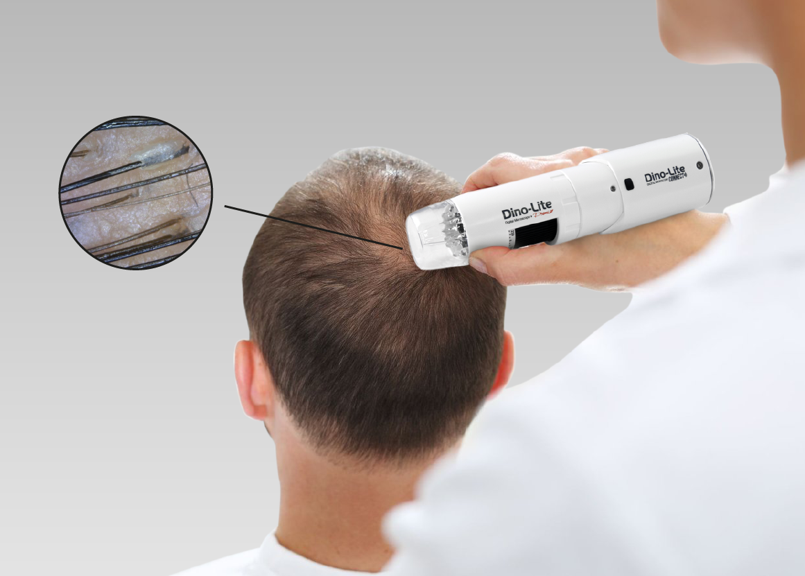 Trichocospe - Dinolite